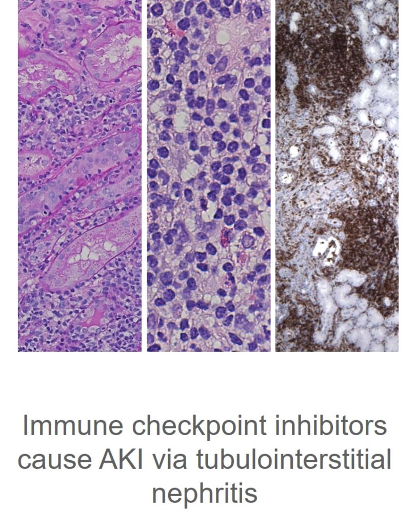 LEAF LAB – Clinical Research in Acute Kidney Injury