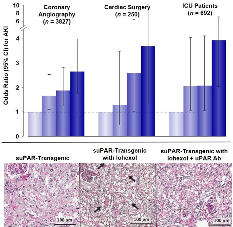 LEAF LAB – Clinical Research in Acute Kidney Injury